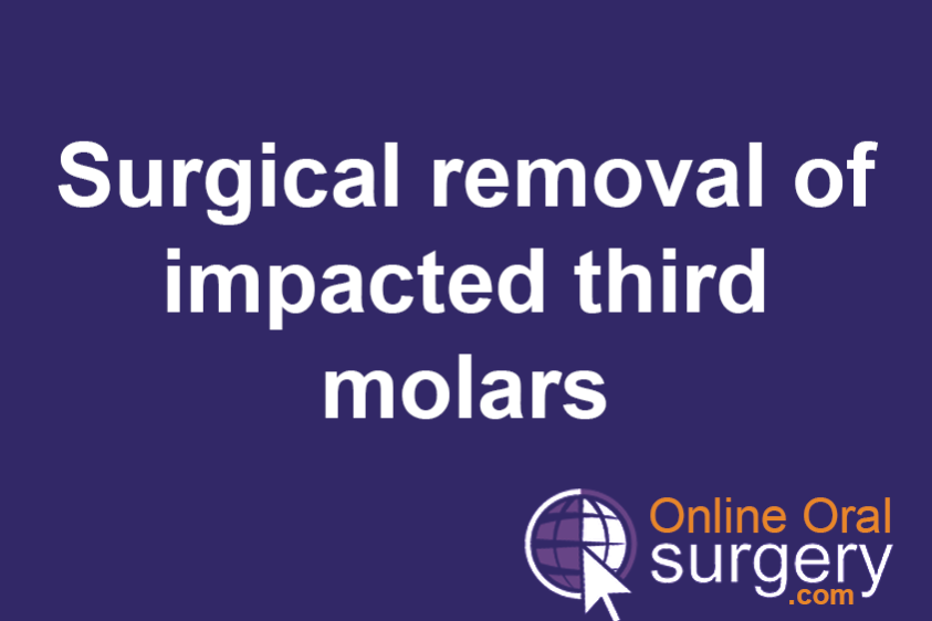 Third Molar Surgery – Online Oral Surgery