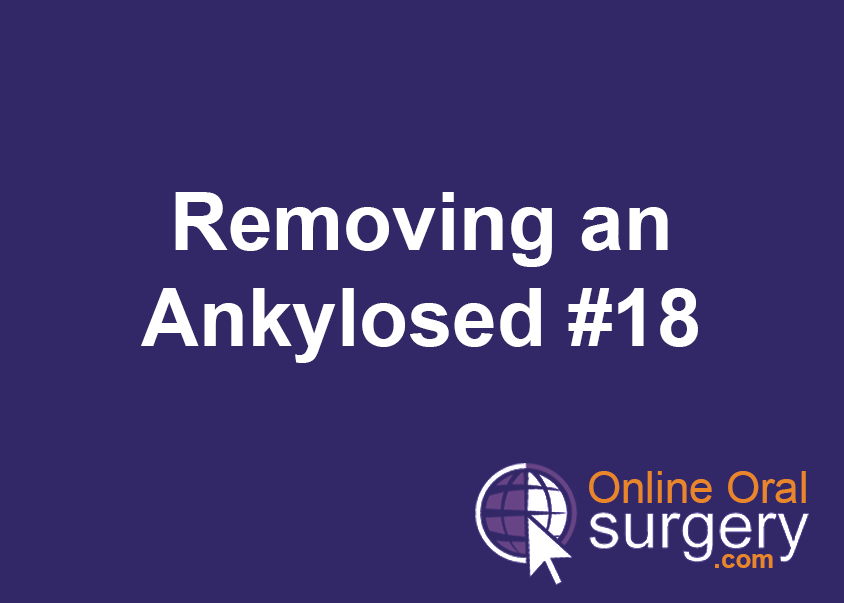 Surgical Extractions – Online Oral Surgery