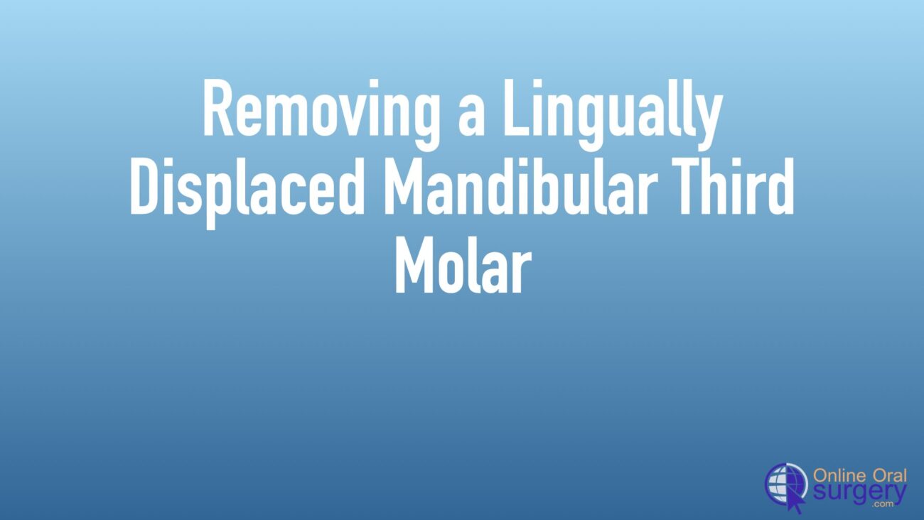 Avoiding and Managing Surgical Complications – Online Oral Surgery